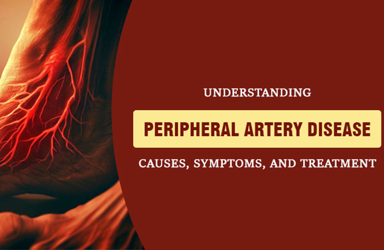 Deborah; Heart; Artery; PAD Screening Event